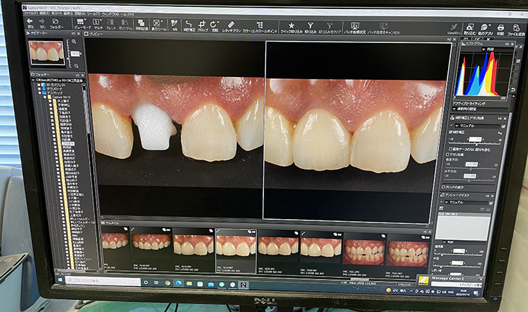 クリニック紹介 : 練馬区江古田のおざわ歯科インプラントクリニック